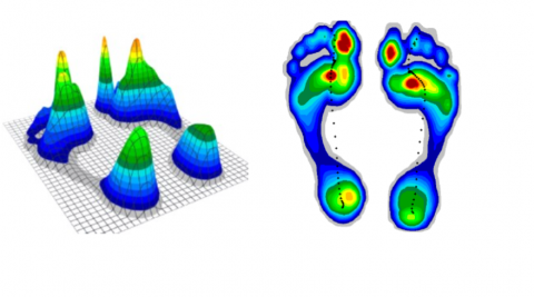 Baropodométrie électronique en podologie - Action Podo